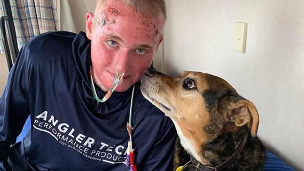 Eruption survivor tells of long road to recovery | Otago Daily Times ...