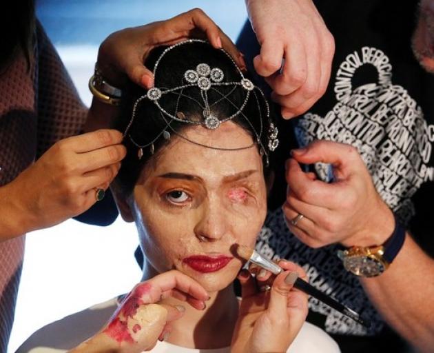 Acid attack survivor takes to NY catwalk | Otago Daily Times Online News