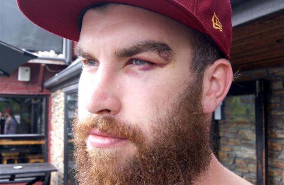 Visa check 'overdue' – lawyer | Otago Daily Times Online News